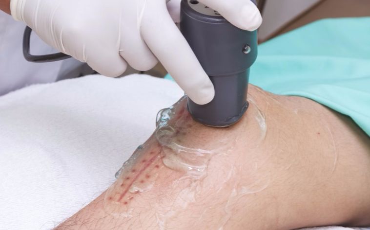 超声波【B超】检测时涂的胶有什么用?