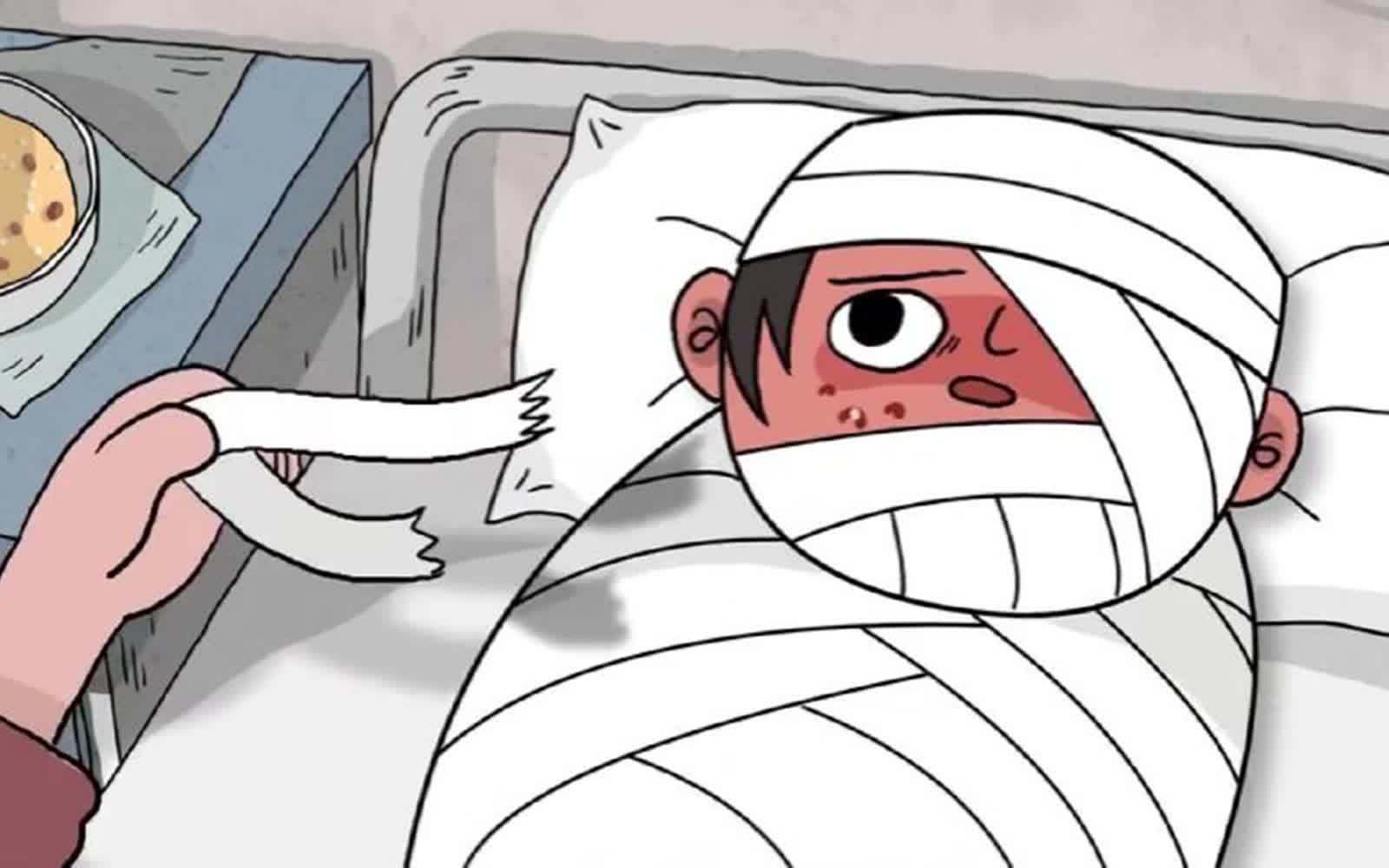 讽刺动画,男孩长了些痘痘而已,但无良医院却小题大做