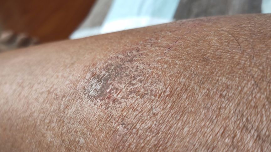 陨石的能量及冶病功效太神奇。