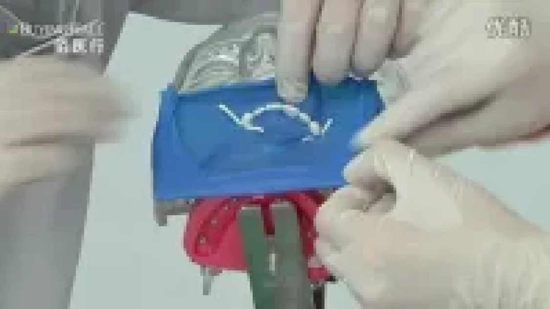 佰医行牙科橡皮障操作视频2