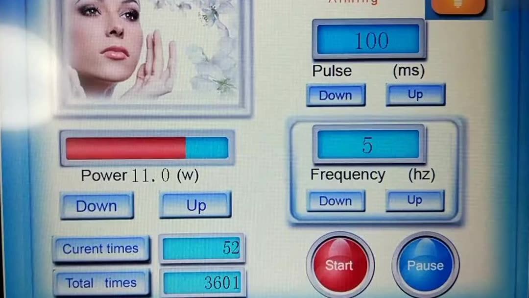 980去红血丝仪器新系统