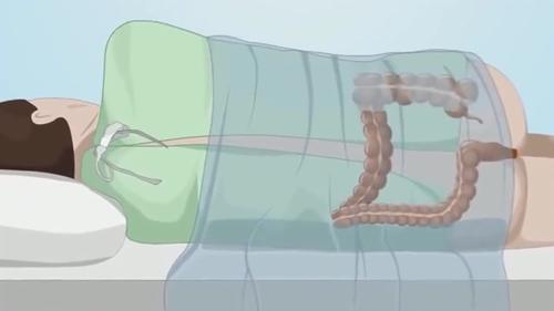 肠镜真的有那么疼吗,3D动画带你体验一下,你就知道有多难受了
