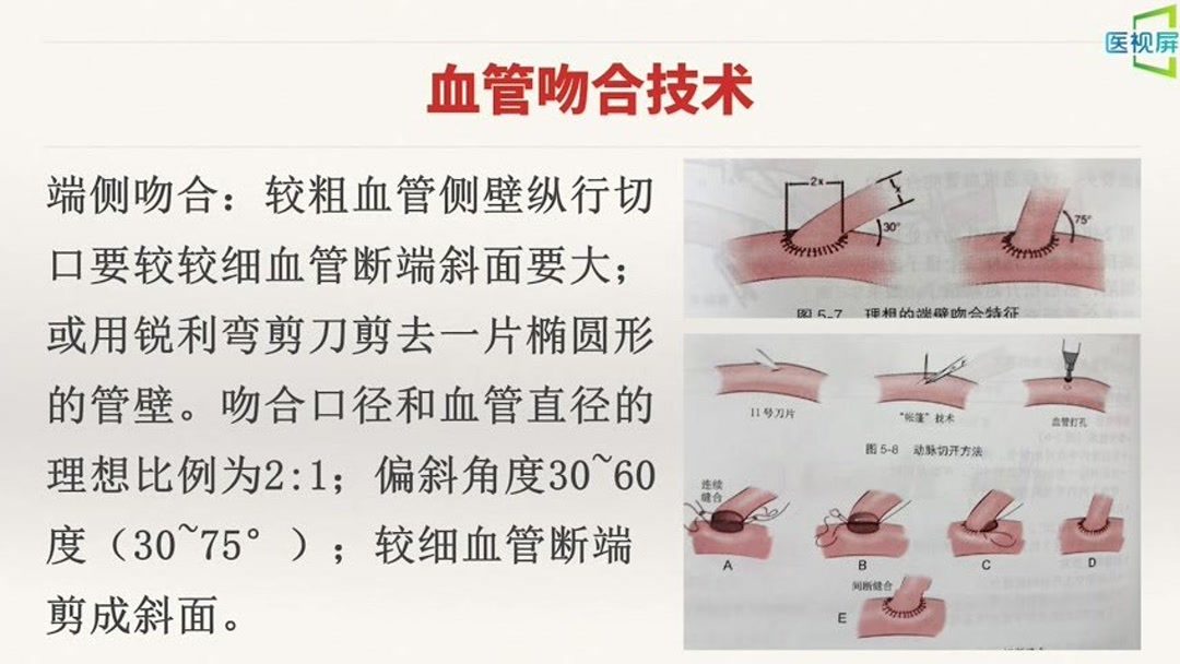 医视屏-显微镜外科血管吻合基础及要求