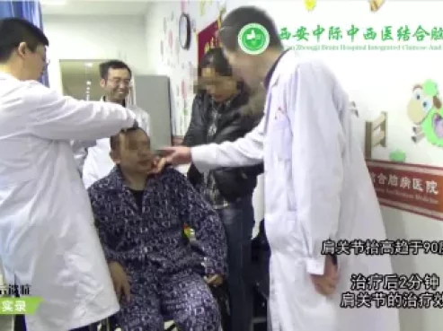 脑出血后遗症患者康复记实录