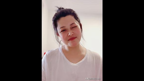 养生小达人*春季抗敏疗法