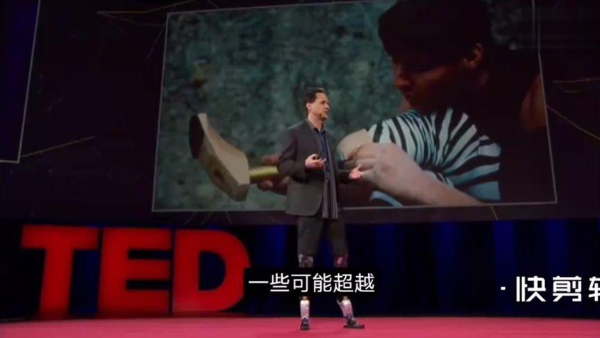 TED演讲:仿生假肢,残疾人的福音