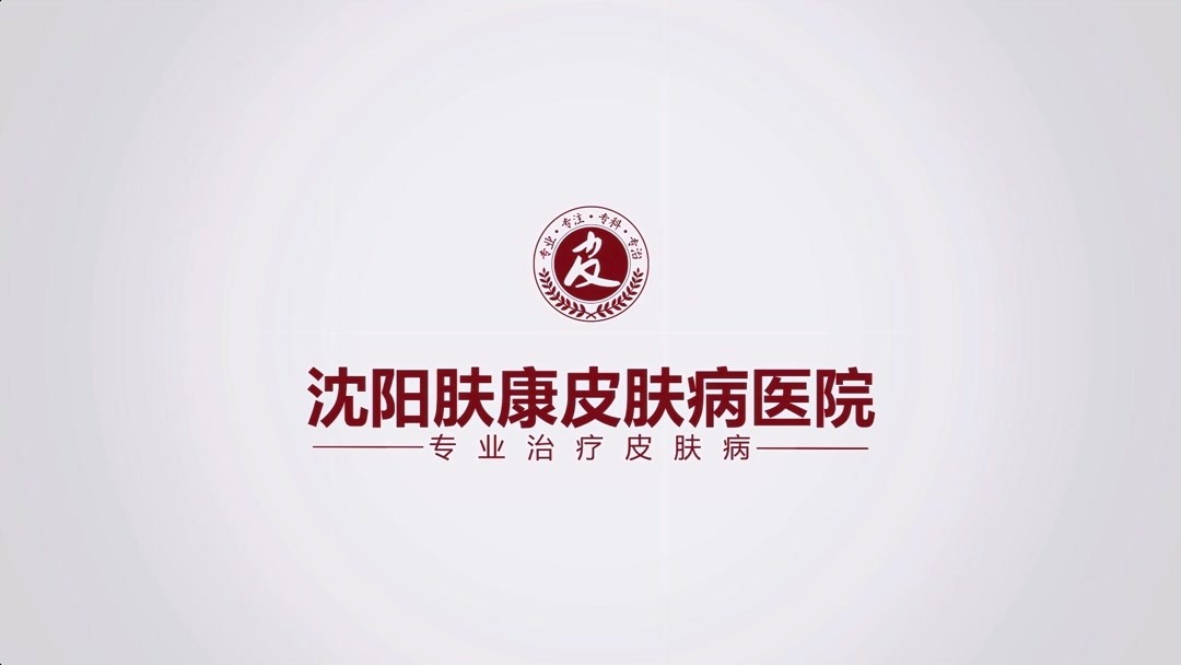 沈阳肤康皮肤病医院讲解脸上长斑的原因