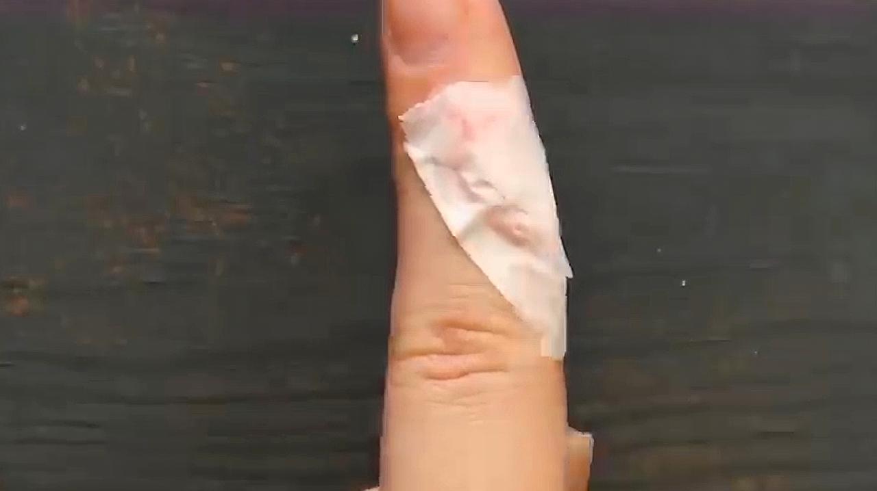 手指被割伤不要紧,鸡蛋也能帮忙止血,厨房必备小妙招!