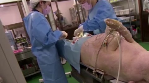 30岁中国美女做另类移植 将猪的器官将给人用