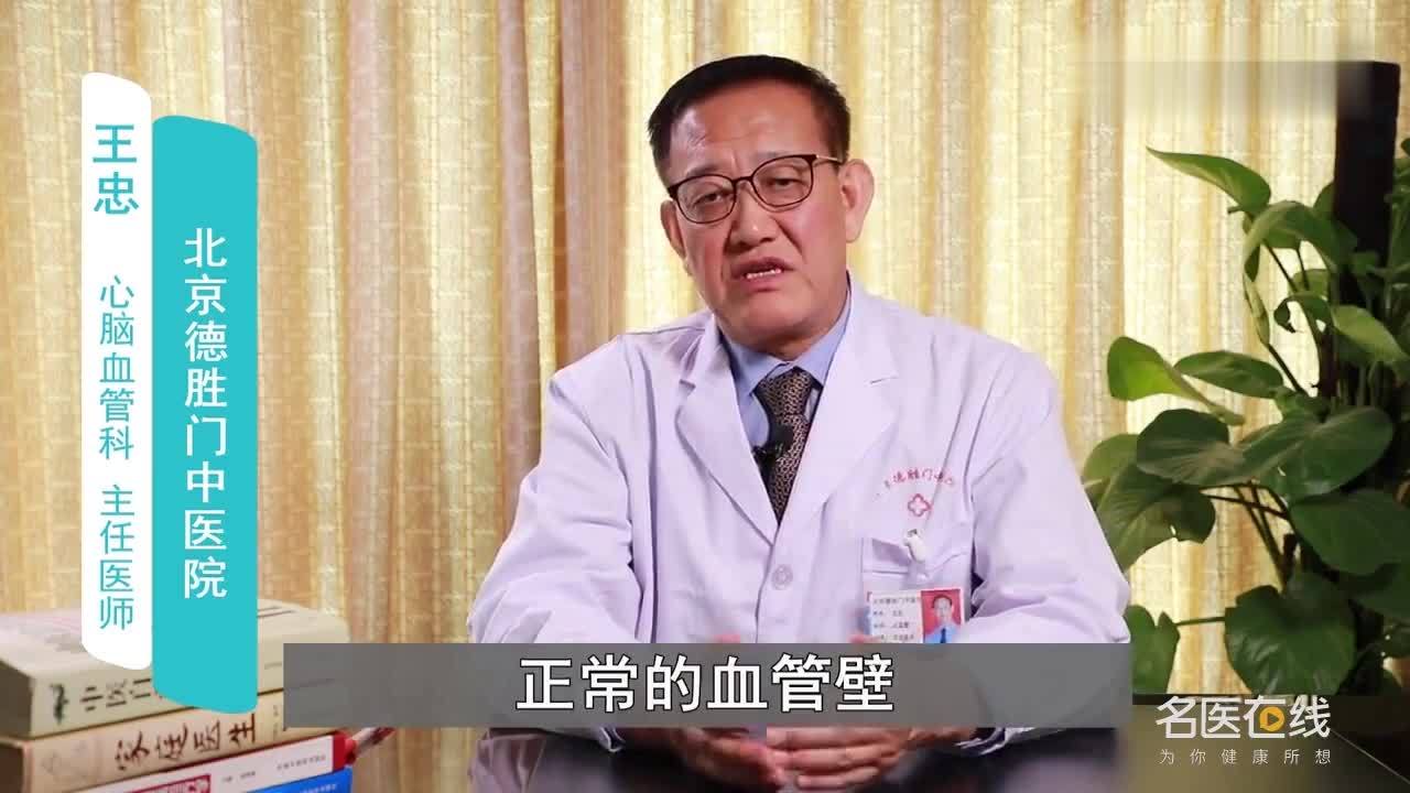 怎样就可以诊断为动脉硬化了?听听医生怎么讲