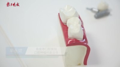 一颗种植牙的"入职上岗记",种牙并没有那么可怕