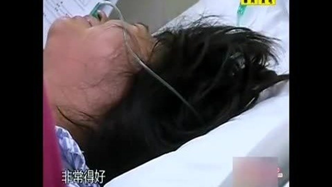 电视节目现场纪录孕妇生产过程