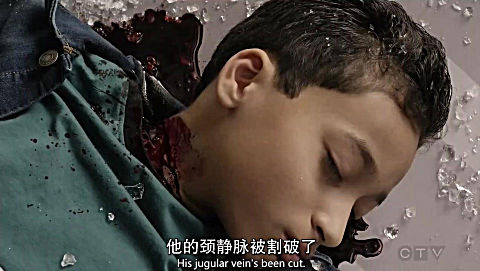 一小孩在机场被钢化玻璃碎片砸伤,紧急抢救中 》