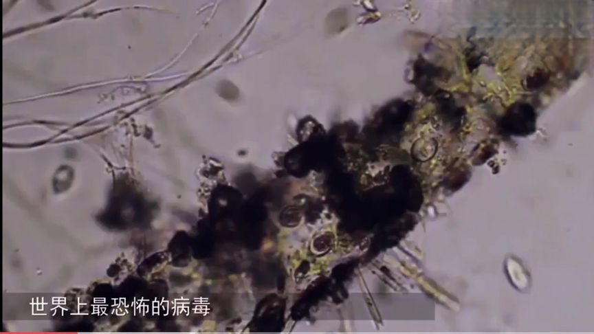 世界上最恐怖的病毒之一,死亡率高达90%