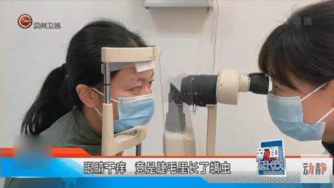 女子眼睛长期干痒,竟然是睫毛里长了螨虫