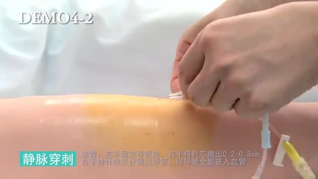 安全型留置针静脉输液(不戴手套)操作流程