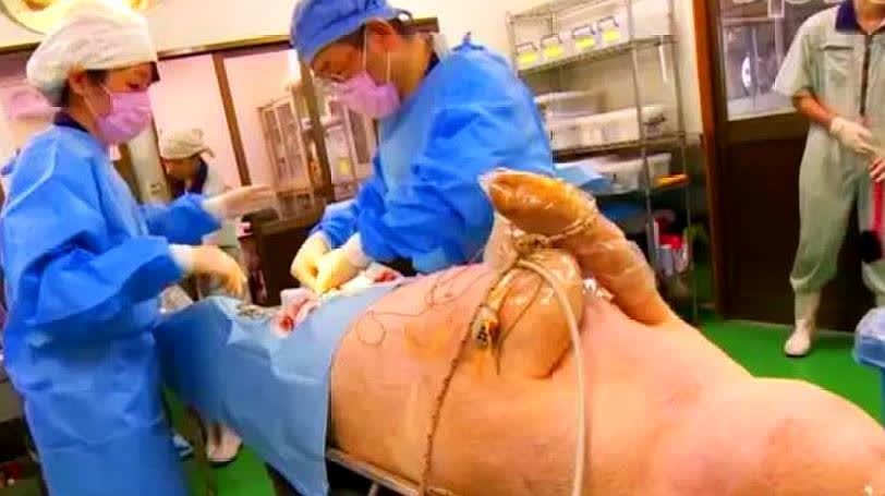 为什么给人“移植器官”要用猪的?得知真实原因后,涨知识了!