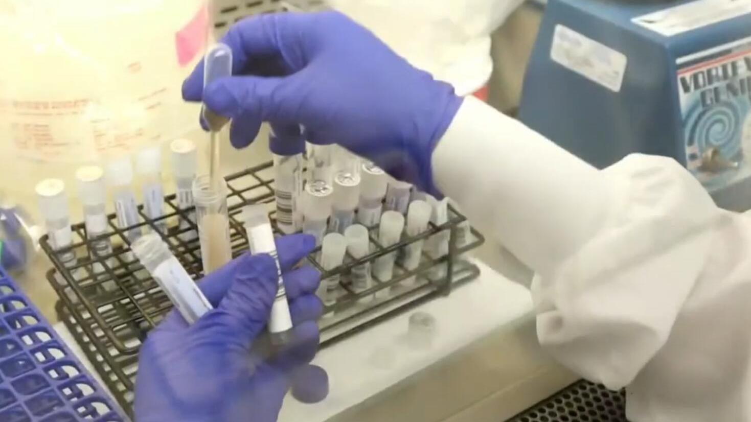 数据概览:美国累计确诊近3060万 福奇称变异病毒已占感染病例30%