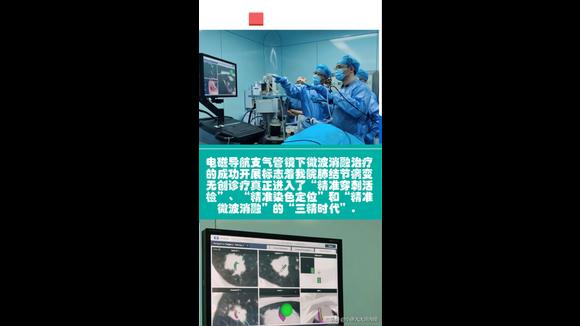肺结节诊疗新利器——电磁导航支气管镜