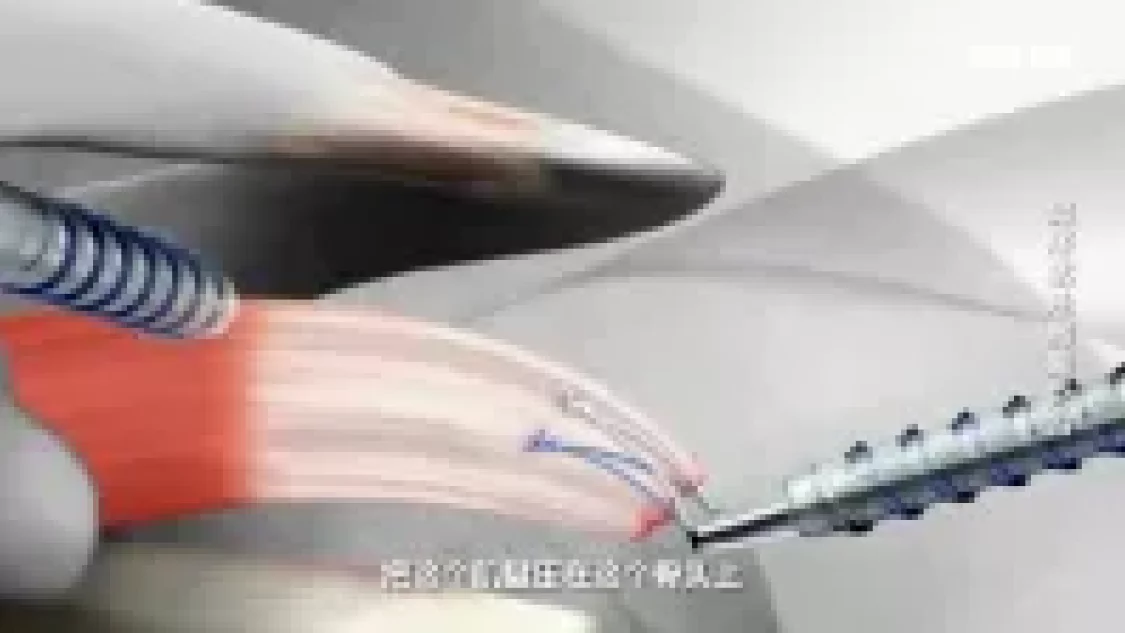 动画演示肩袖撕裂手术
