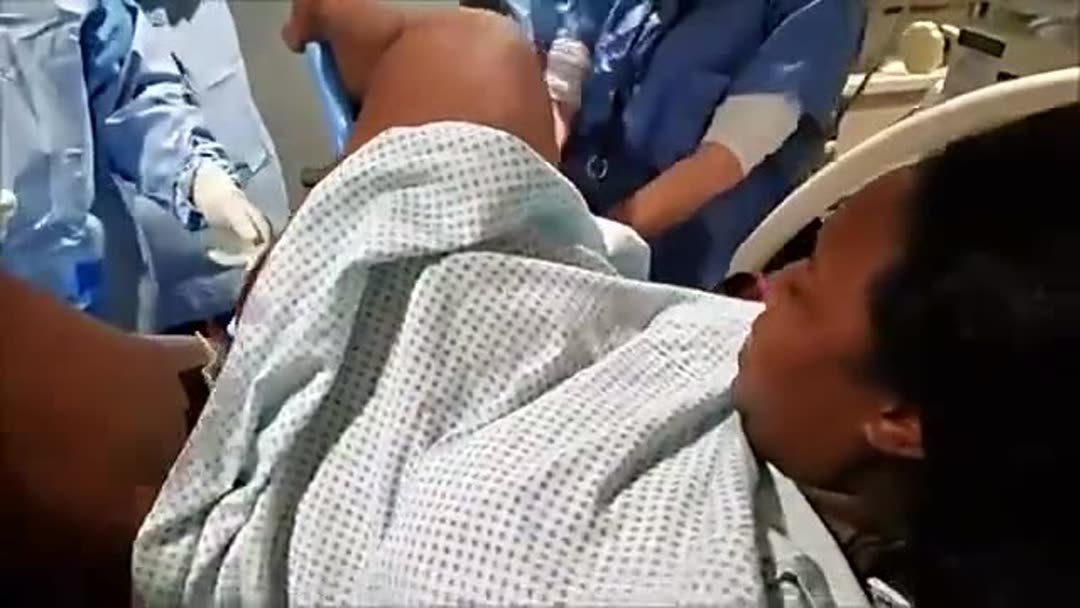 近距离直击孕妇分娩全过程