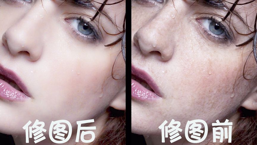 干货|教你PS祛斑