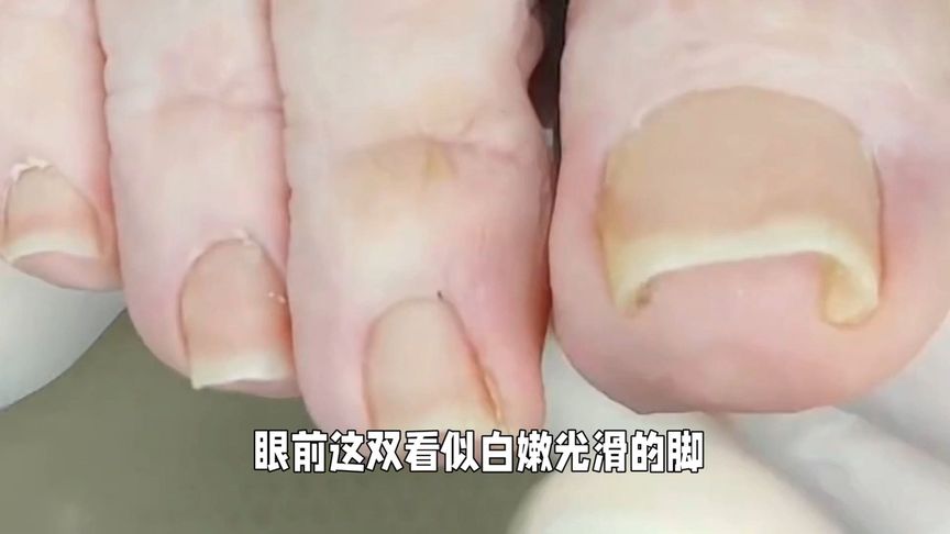 解压视频:修剪脚趾甲,看完整个人都舒服了