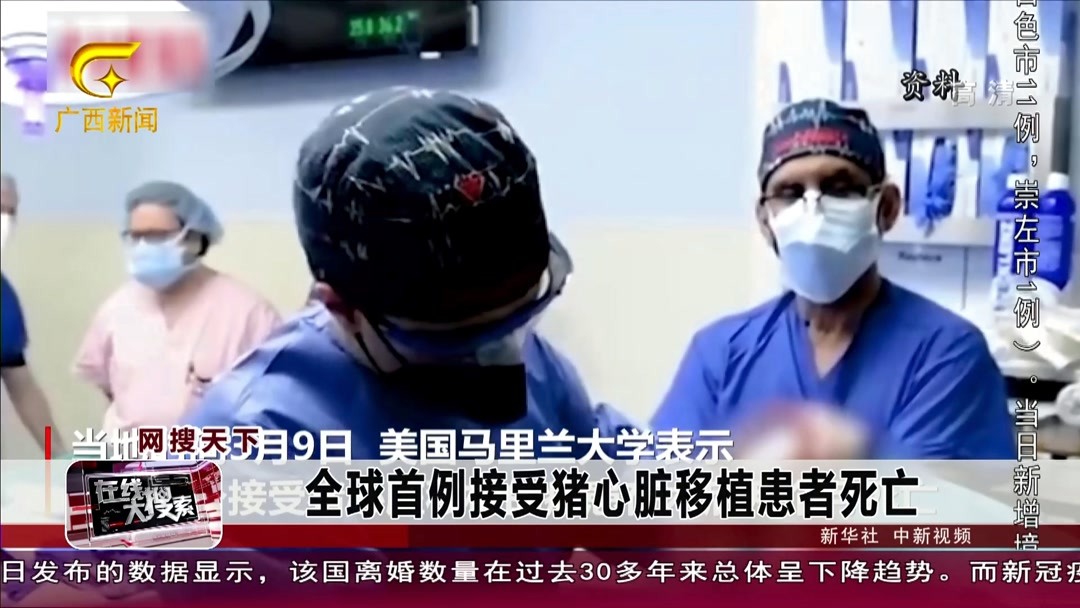 全球首例接受猪心脏移植患者死亡