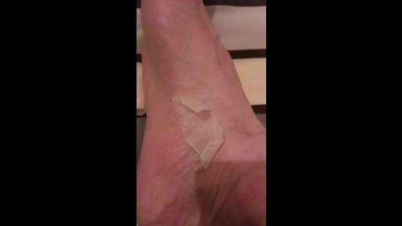 双脚角质层脱落后,脚非常干净,纹路清析,中药泡脚无副作用。