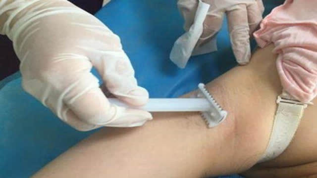 进产房前做“备皮”,这葫芦里卖的是什么药?经历过才懂有多尴尬