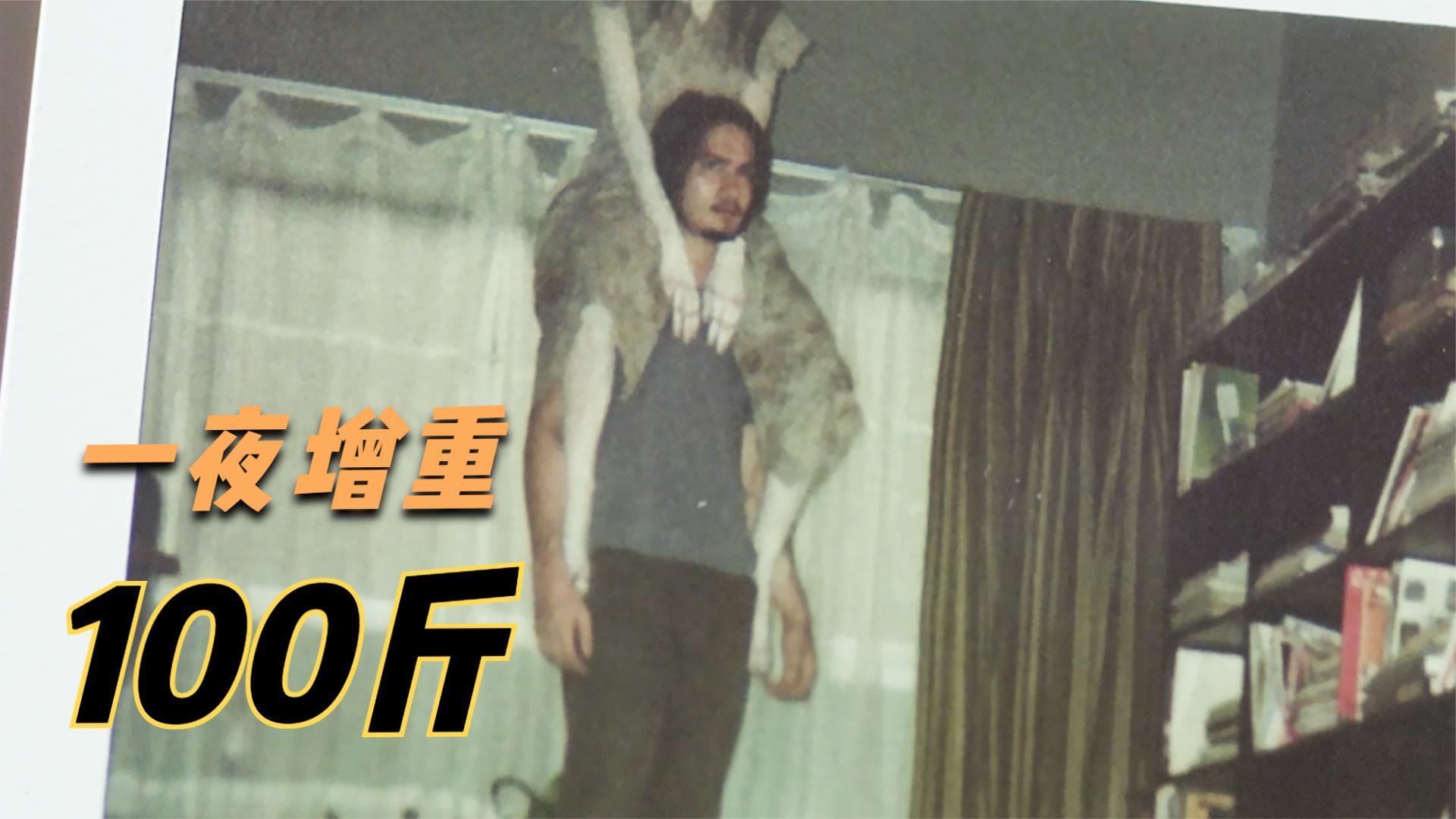 男子车祸后,总是觉得脖子很重,拍张照片才明白发生了什么