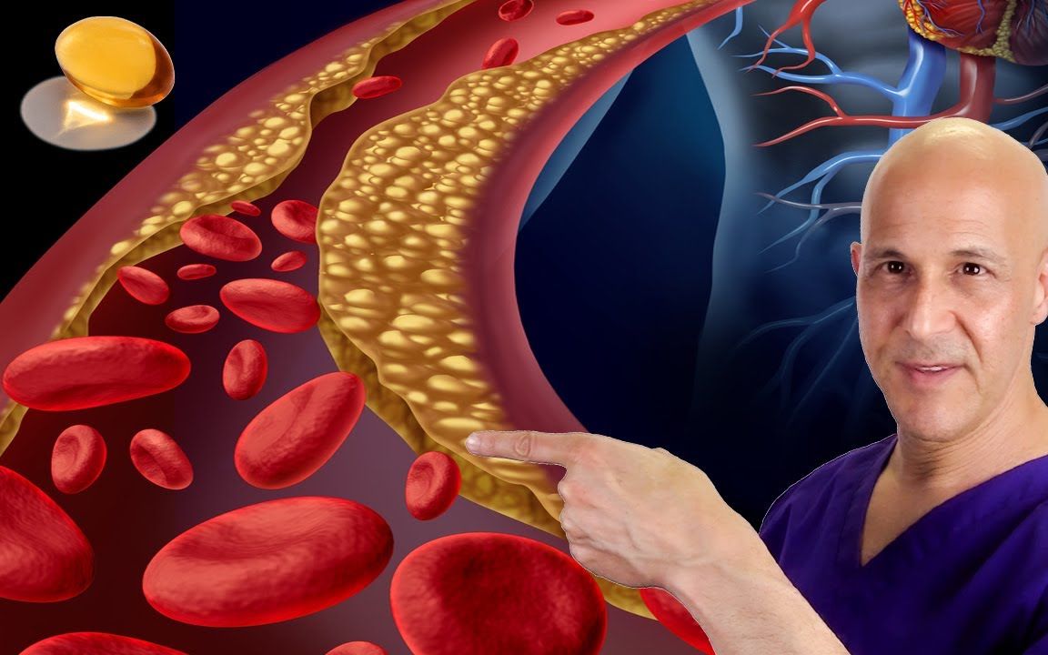 抗斑维生素.远离动脉阻塞 | 曼德尔博士