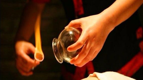 三甲医院男科医生说:拔罐的作用与禁忌!