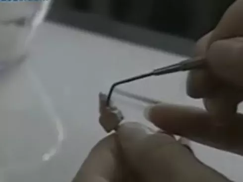 PFM金属基底冠熔模的制作