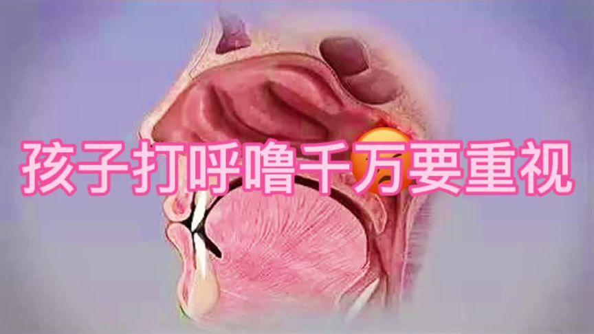 你家孩子打呼噜么?#医学科普