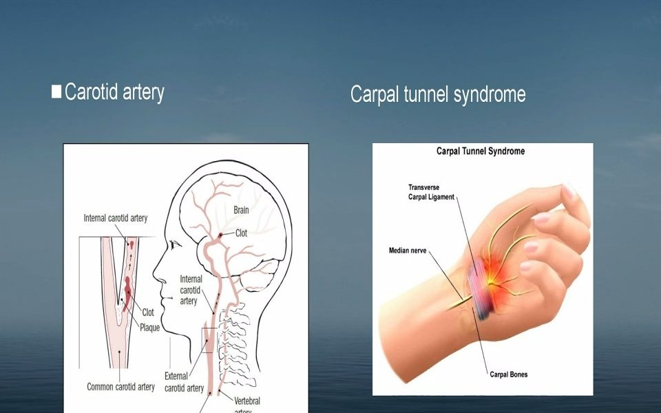 专业医学英语术语单词笔记本——今天讲C