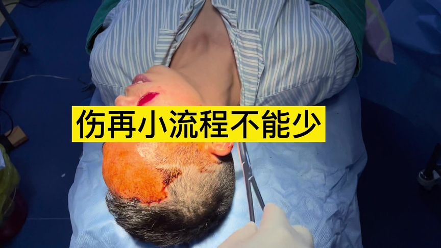伤口手术缝合也好,换药处理也罢,原则、规矩都是要讲的
