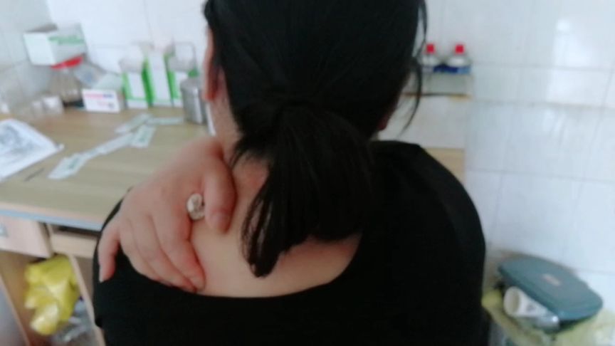 后背痛点放血