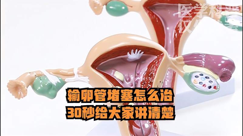 输卵管堵塞怎么治,30秒给大家讲清楚