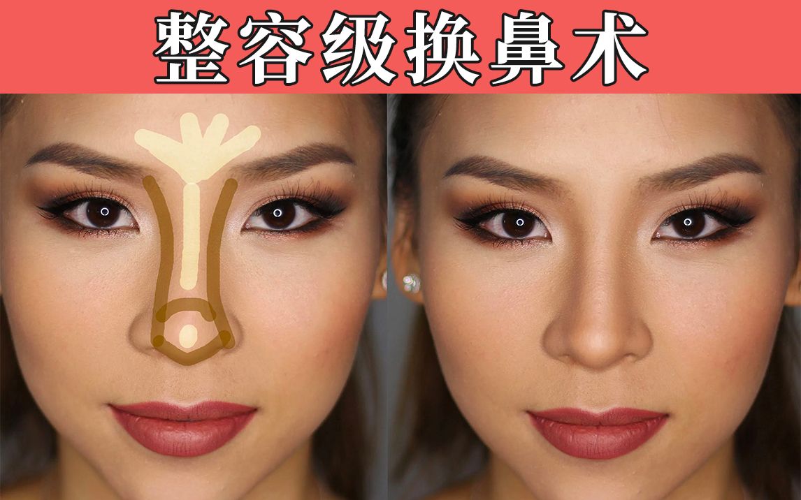 塌鼻梁、宽鼻翼、蒜头鼻,怎么科学修鼻影?
