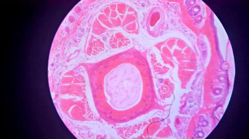 显微镜标本《尾横切》,放大1600倍很漂亮!