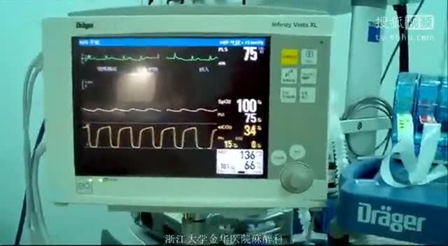 郭文贵 swf-经鼻盲探气管内插管--牙齿松动