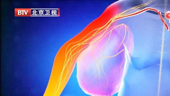 生命缘:手术费终于凑齐,男童的肿瘤呈几何倍数的增长,十分巨大