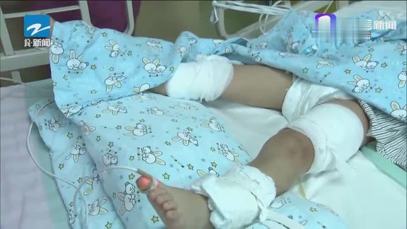 5岁男孩遭恶狗撕咬 爱心涌动6小时捐35万