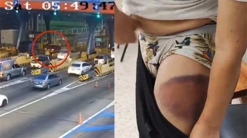 湖南男子被卖缅甸途中跳车逃生:常遭电棍折磨!