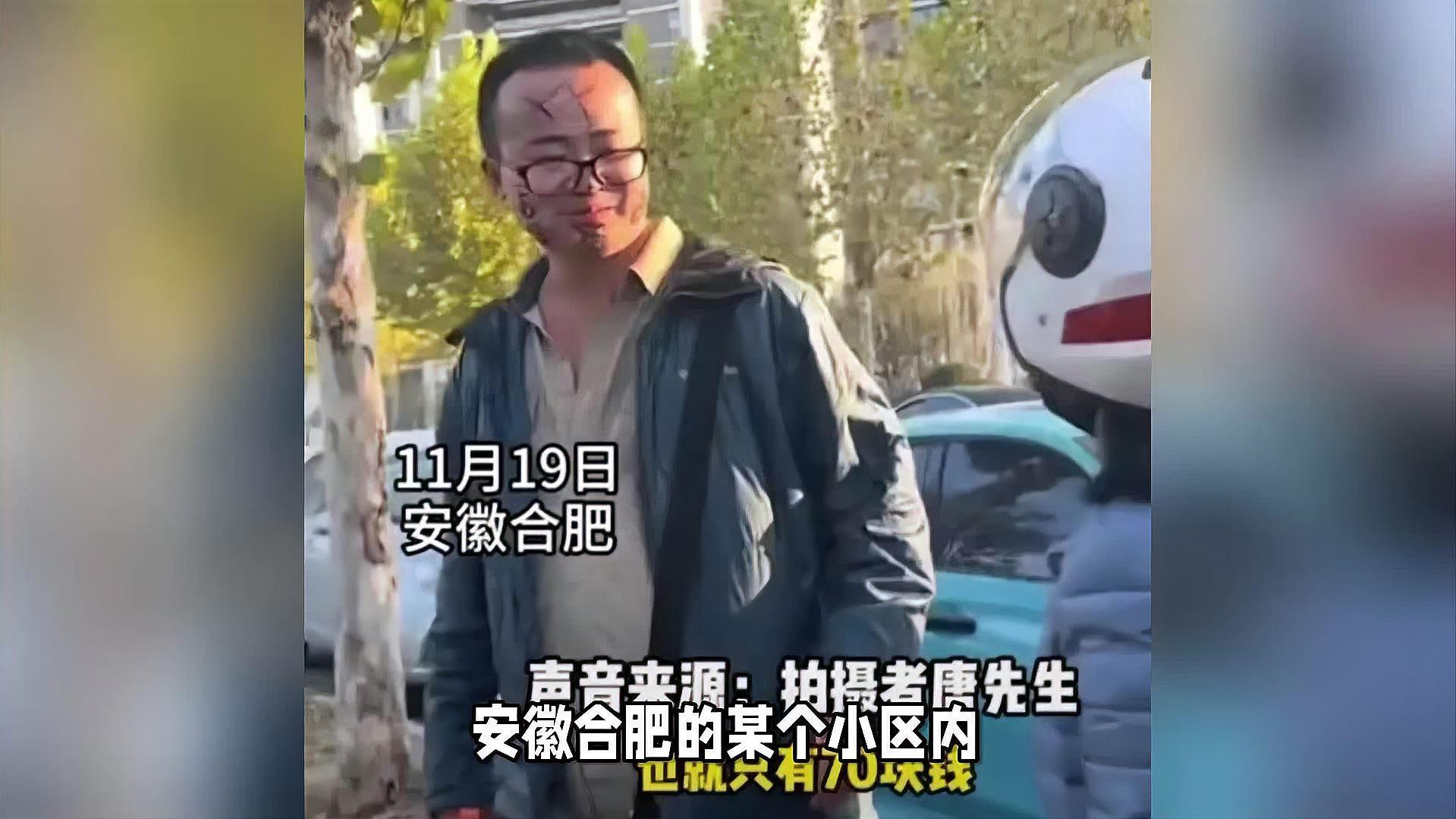 安徽残疾男子小区贴广告,被物业在脸上涂鸦羞辱!事件曝光引热议