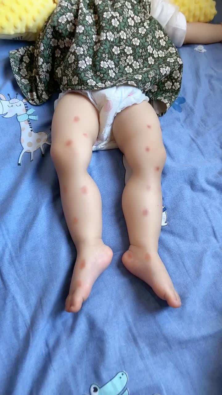春夏难免被蚊子叮,这个东西一定要提前备上,新生儿孕妇可用,全家都需要