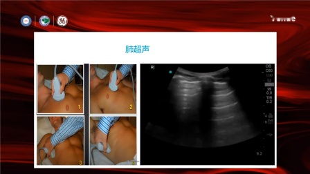 围术期颈部,腹部,血管及全身超声指南解读