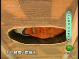 员针除腰痛 埋线解便秘
