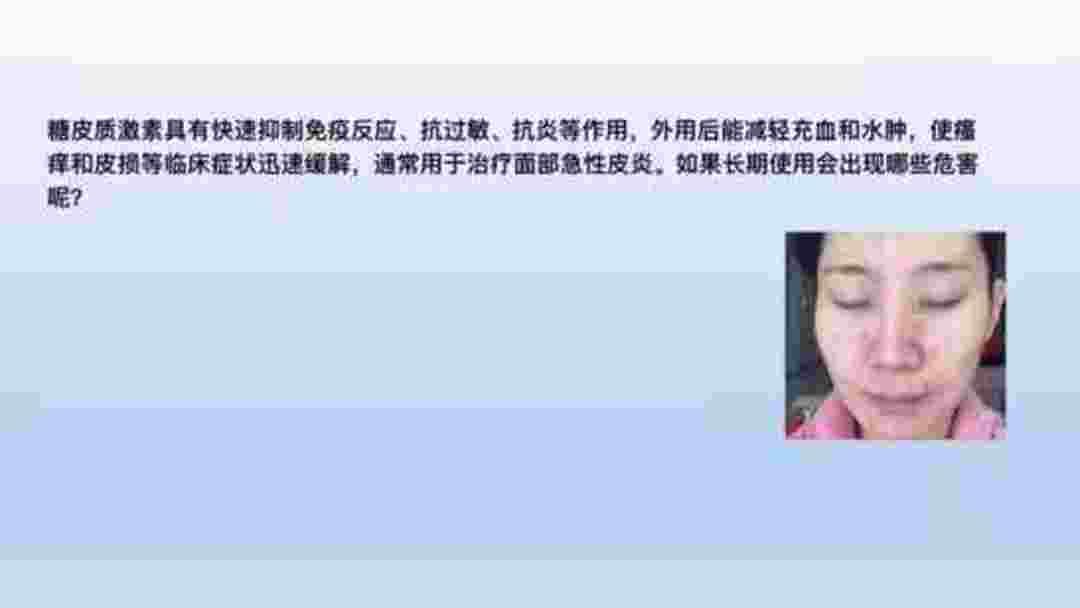 激素脸的表现与自我鉴定